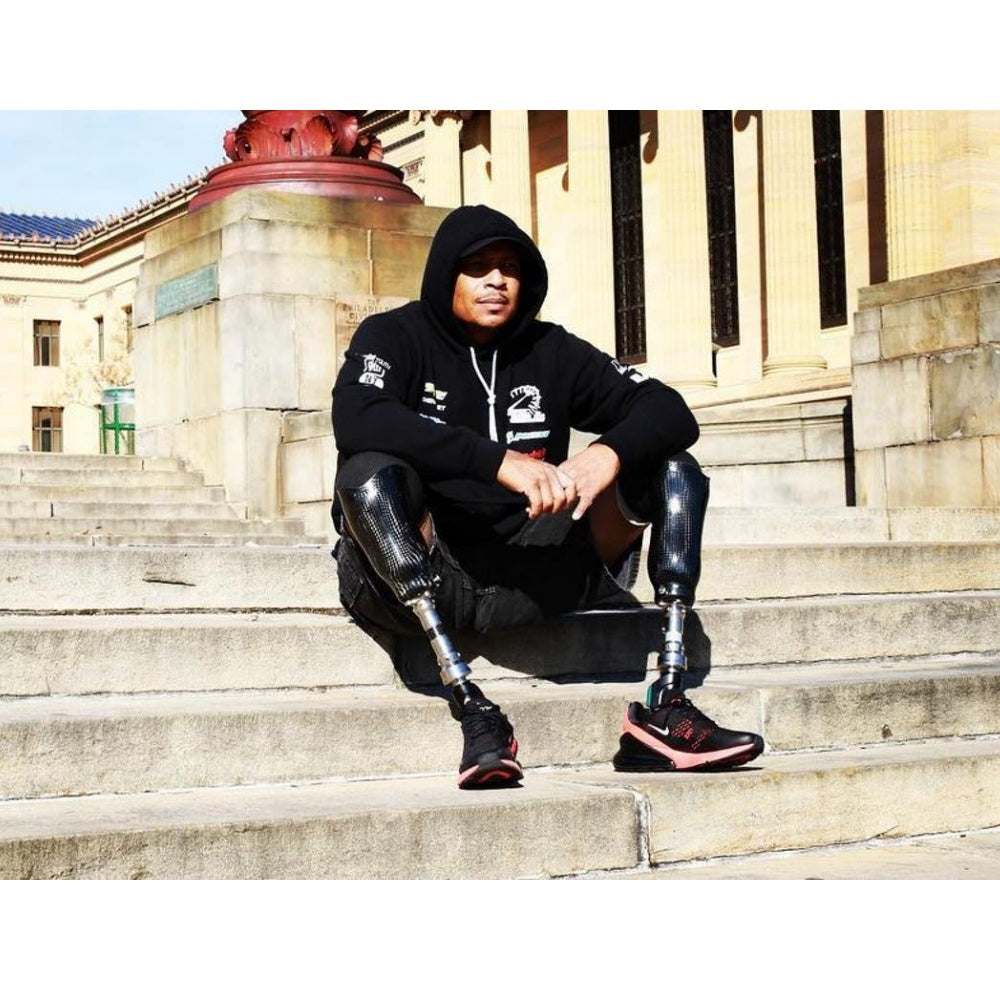 Gallery – prostheticdesign